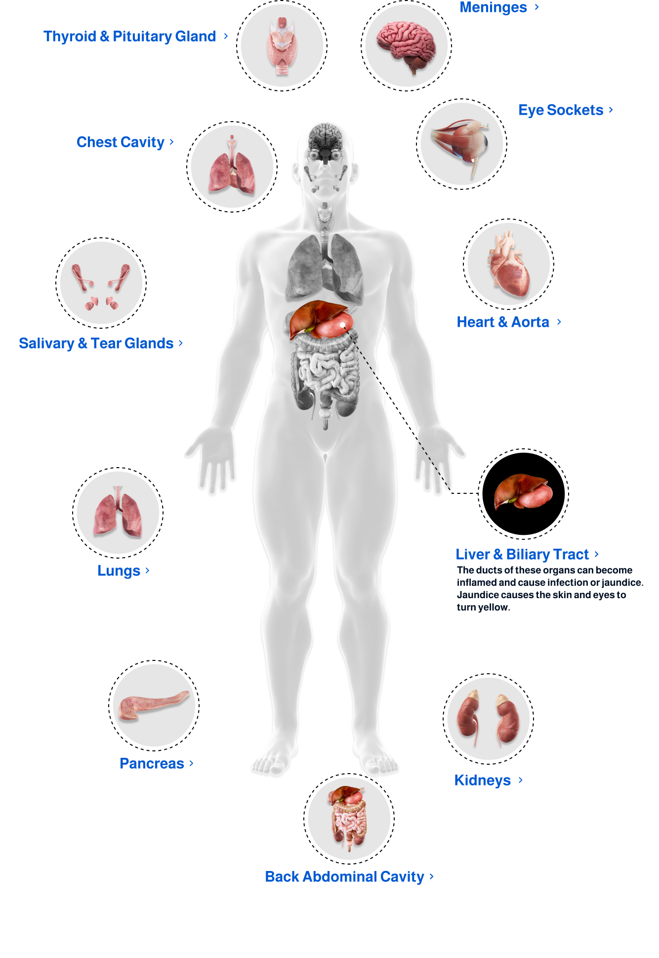 What are the Symptoms of IgG4 Related Disease?