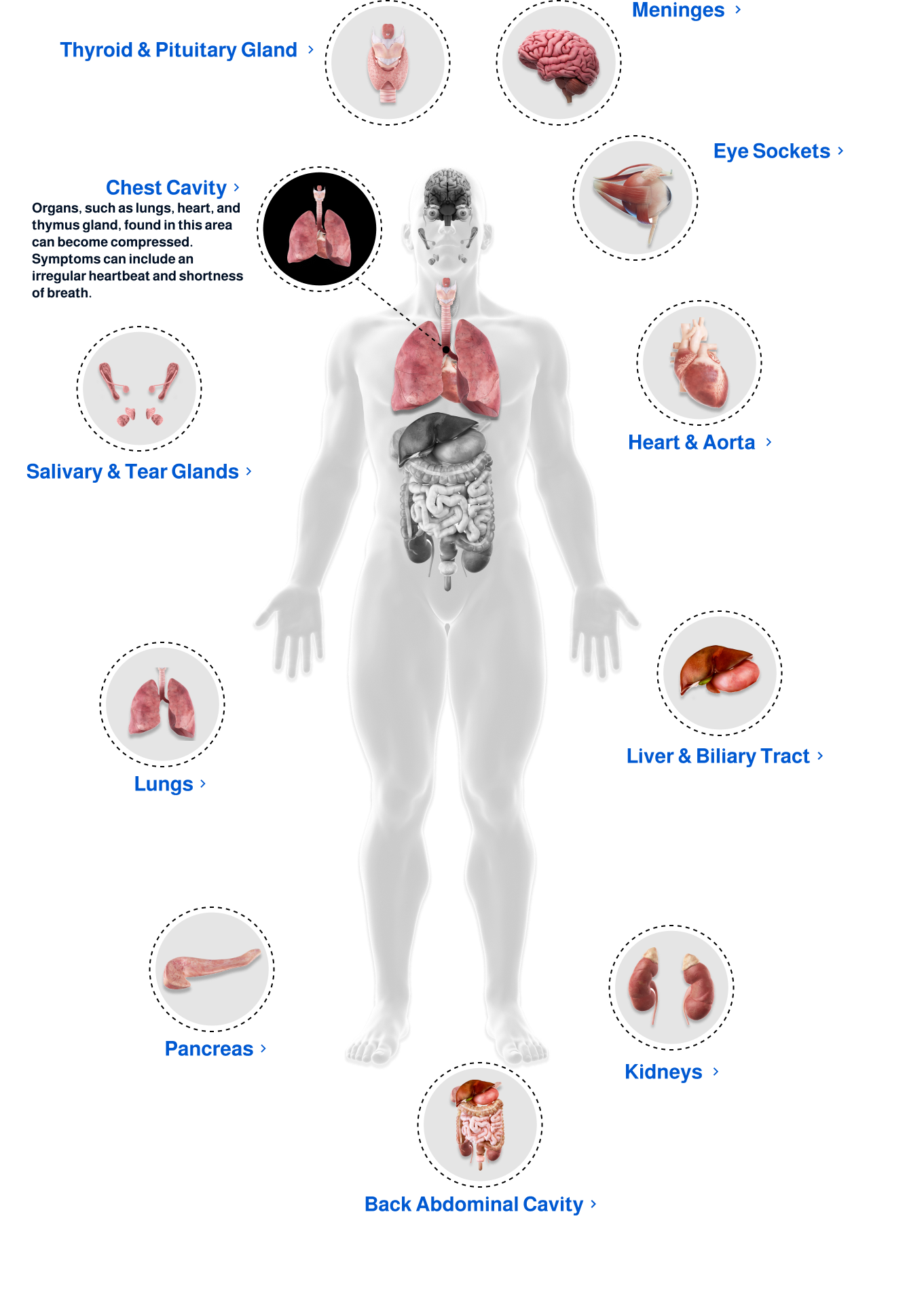 What are the Symptoms of IgG4 Related Disease?